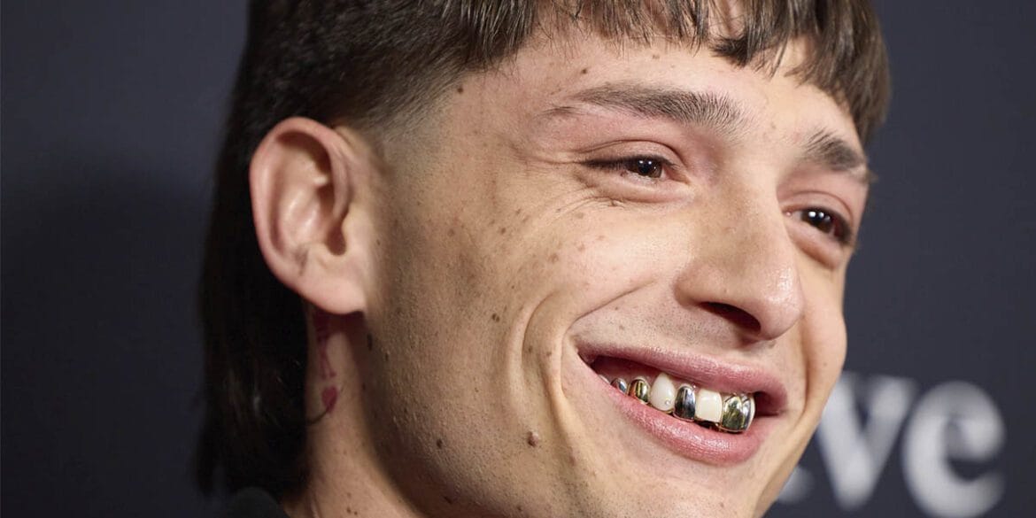 Nueva dentadura de Peso Pluma sorprende más que su Grammy - Sergio Valle